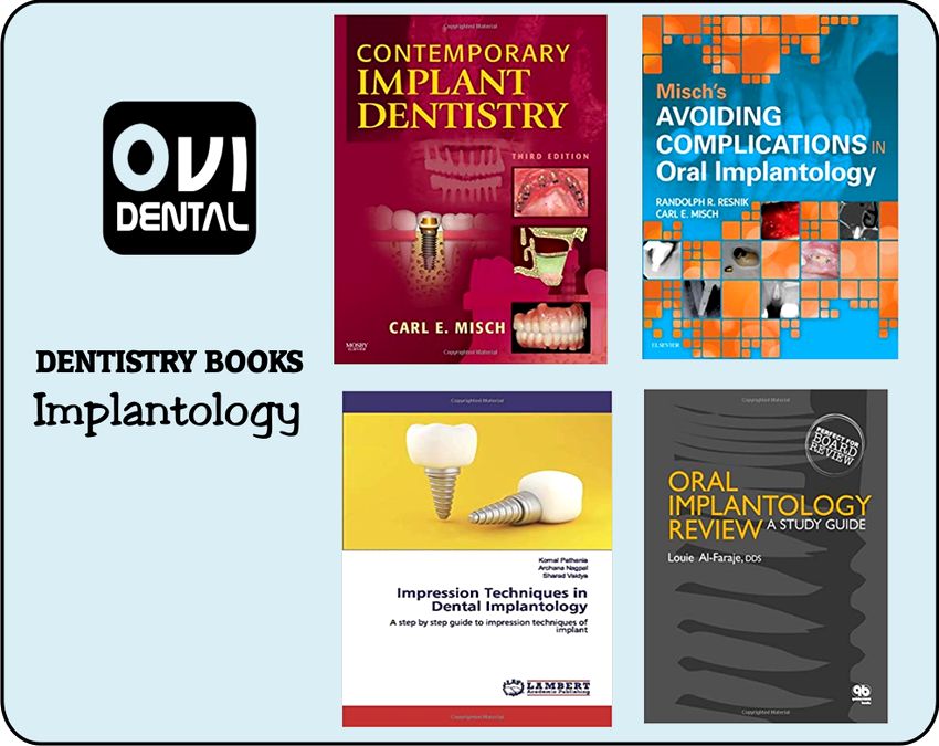 7 IMPLANTOLOGY BOOKS that every specialist must read