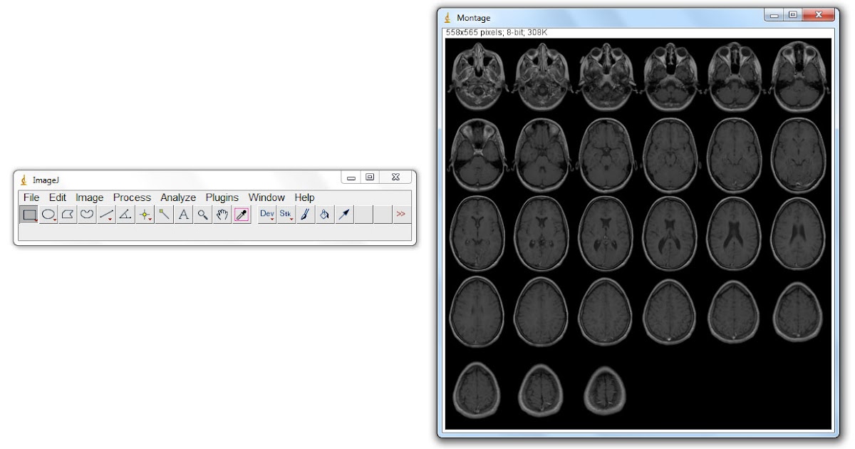 My imageJ: เมนู Image with ImageJ [ตอนที่ 38] Stacks tools, การแปลงภาพ Montage เป็น Stack