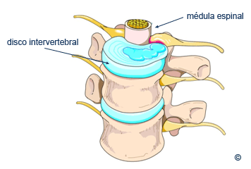 Quiropráctica: Espalda Sana y salud óptima en la Marina Alta: Problemas ...