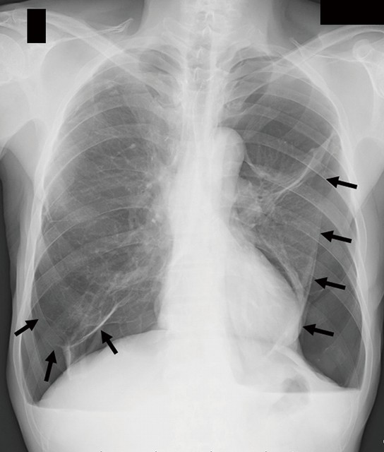 TYWKIWDBI ("Tai-Wiki-Widbee"): "Buffalo chest" and the American bison