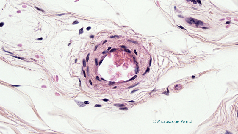 Human Skin Under Microscope