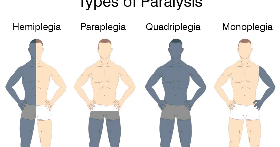 Parijatak Ayurveda- Best Ayurvedic Hospital in Nagpur: Types of ...