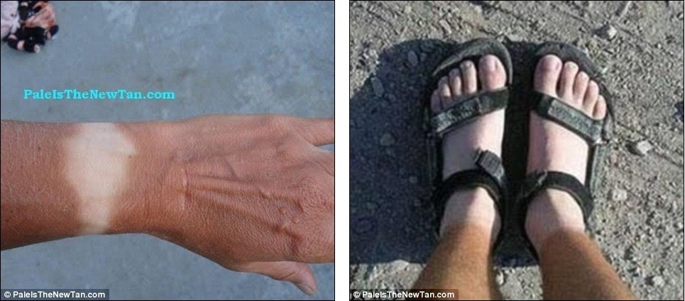 They're beyond the pale! Take a look at the world's most terrible tans ...