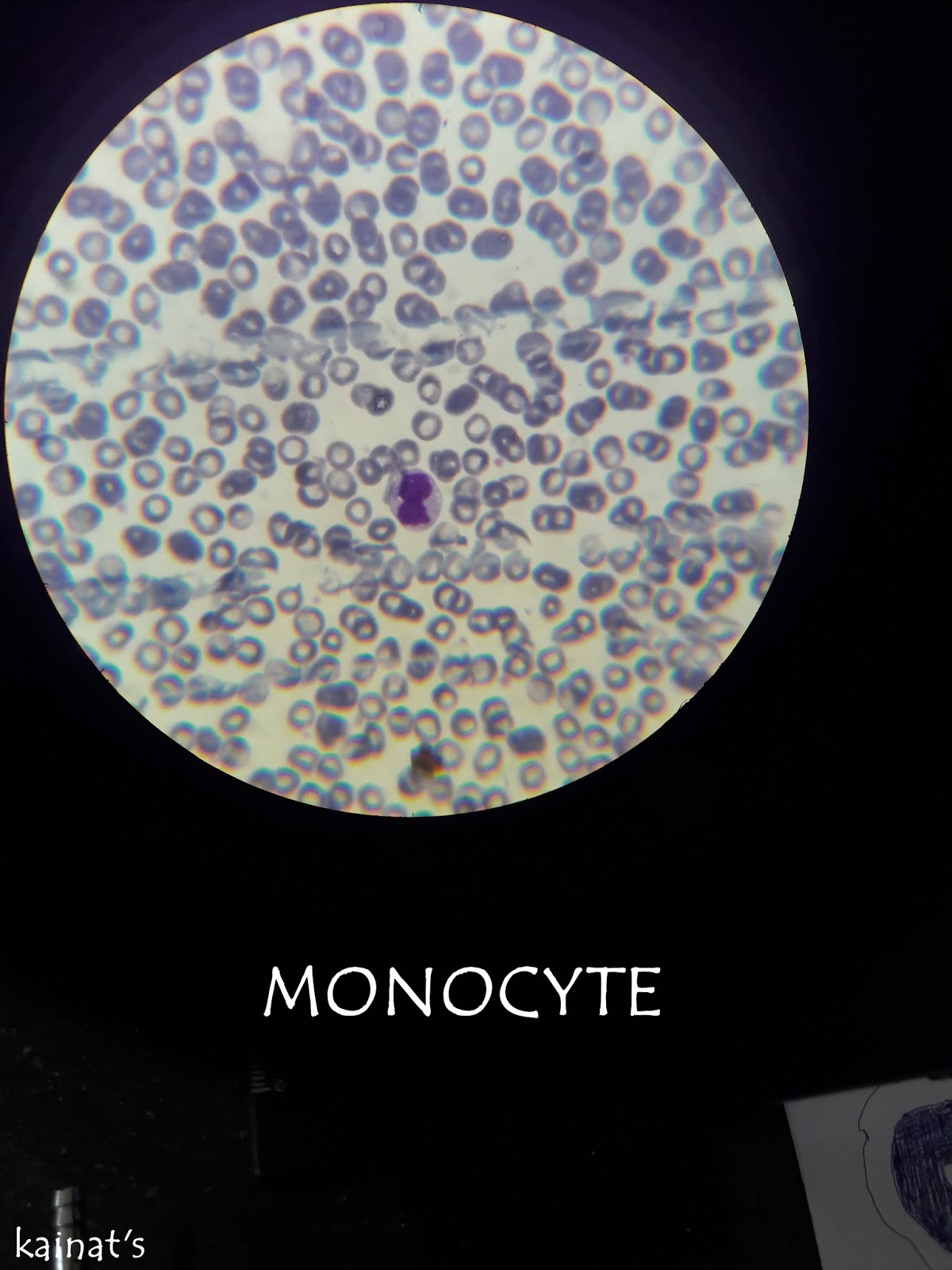 Pathology (slides and practical stuff ALL, 2016) 3rd year