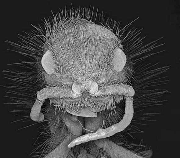 Microrganisms Under Microscope, Microscopic Photos of Micro-Organisms ...