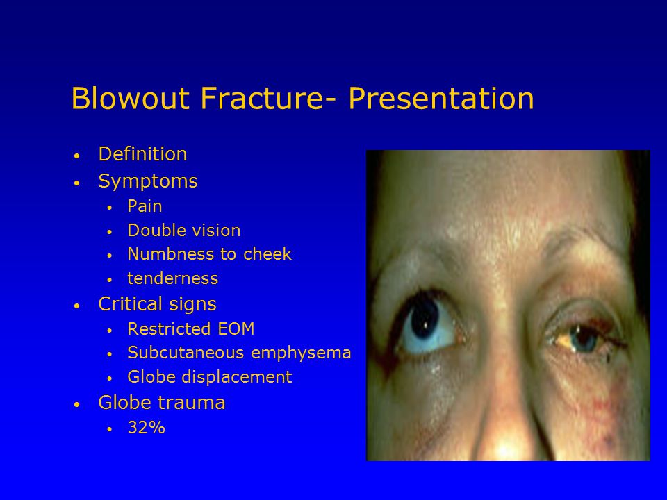 EXAMS AND ME : Vision 2020: Tear Drop Sign