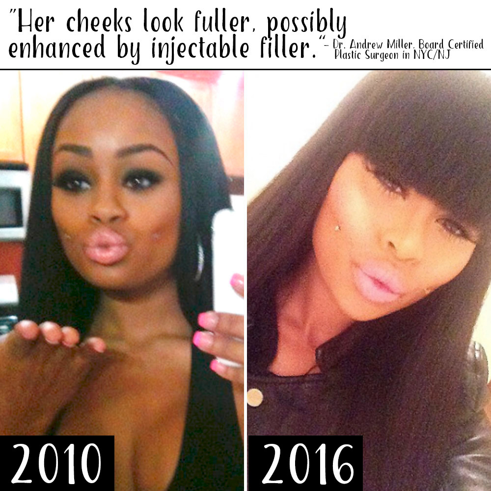 Blac Chyna Before Surgery12 Defining Pictures