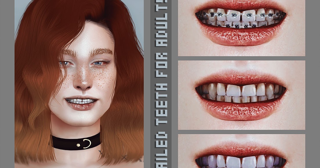 The Sims 4 mody do gry: Szczegółowe zęby dla dorosłych od Magic Bot