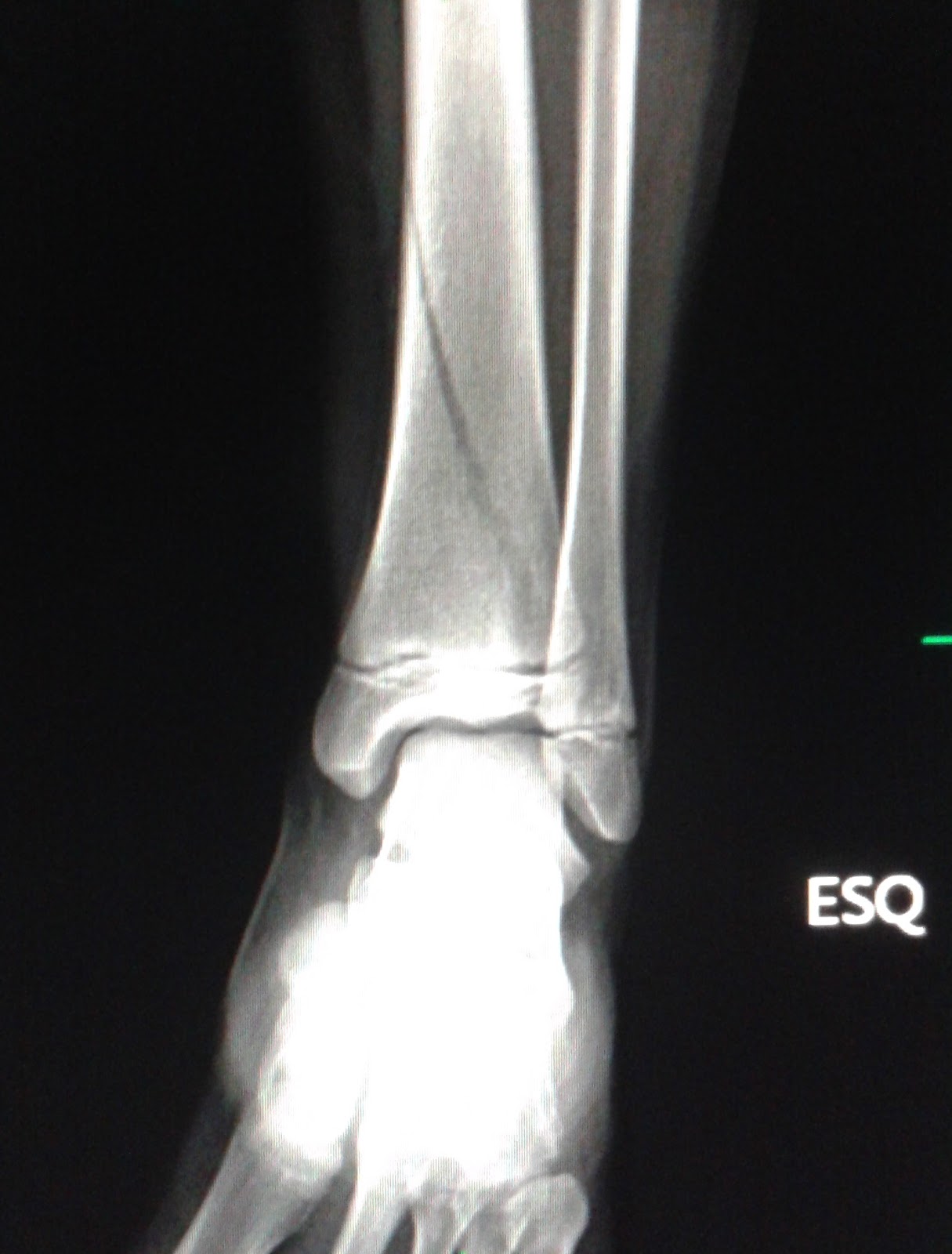 DICAS DE RADIOLOGIA - Tudo Sobre Radiologia: IMAGENS RADIOLÓGICAS ...