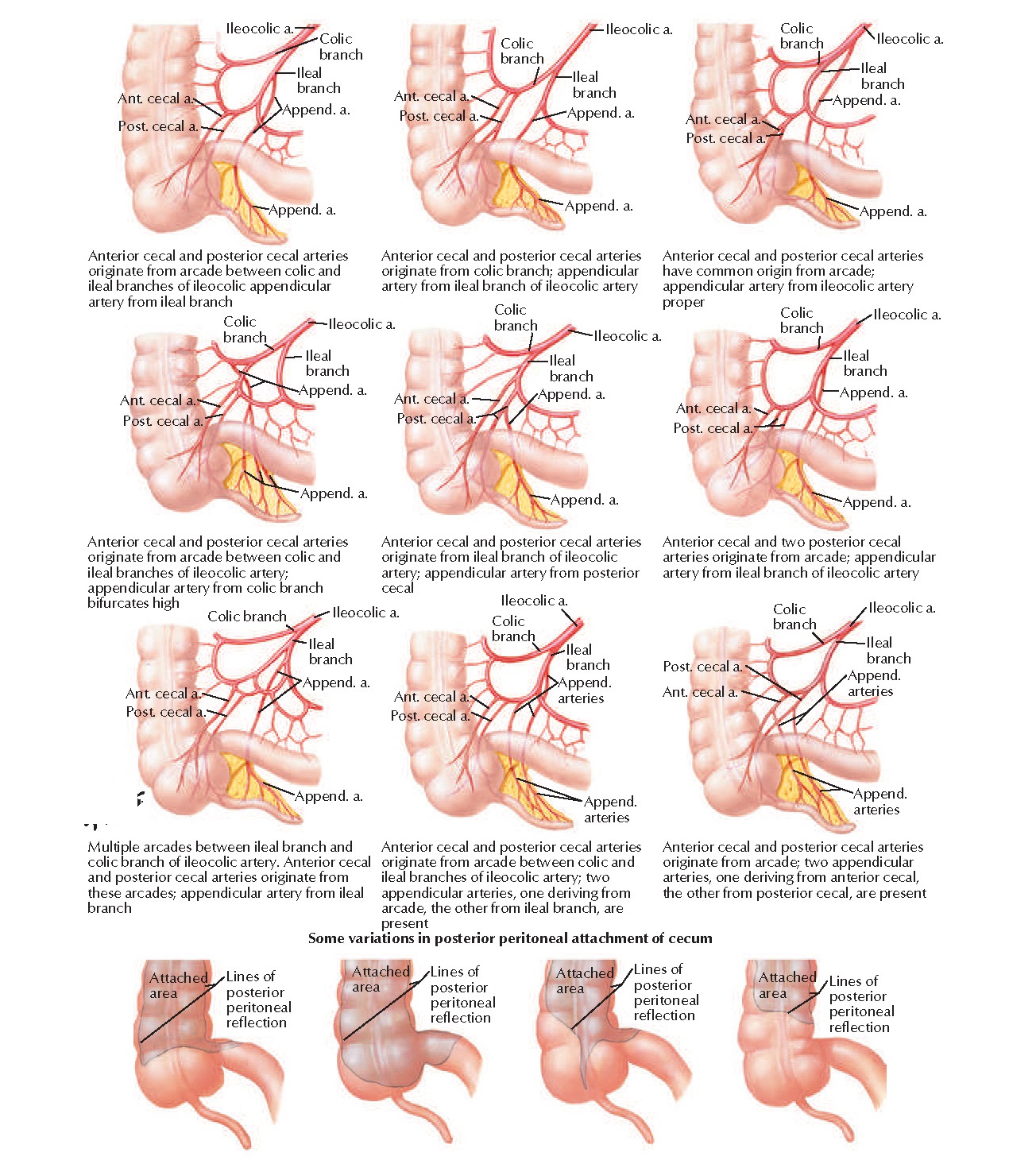 Variations in Arterial Supply to Cecum and Posterior Peritoneal ...