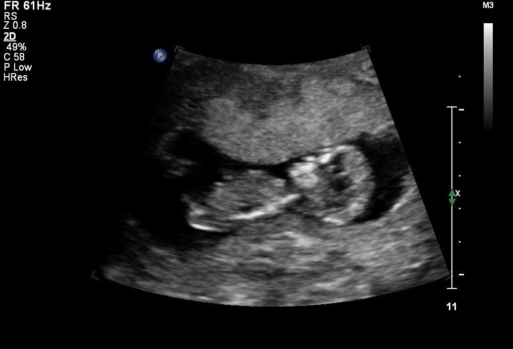 Just Dad Water: The First Scan: Baby is Real!