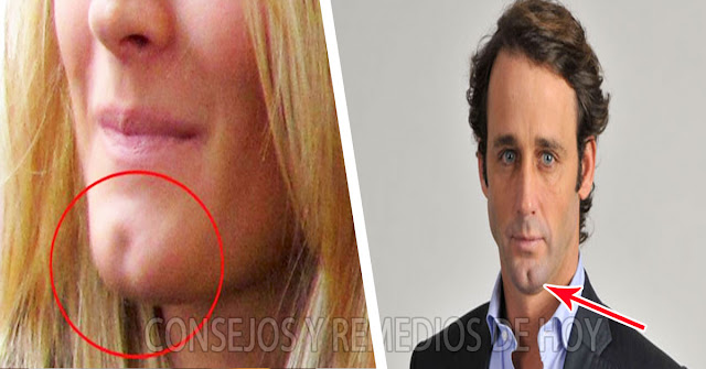 Si Tienes Este Hueco En Tu Barbilla ¡Debes Leer Esto INMEDIATAMENTE ...