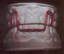 FABRICAR LA APARATOLOGIA UTILIZANDO DIVERSAS TECNICAS Y MATERIALES ...