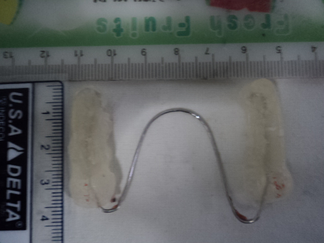 ODONTO-ESTOMATOLOGICA: APARATO DISYUNTOR HIRAX