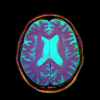 Nevit's blog: Color MRI of the Brain