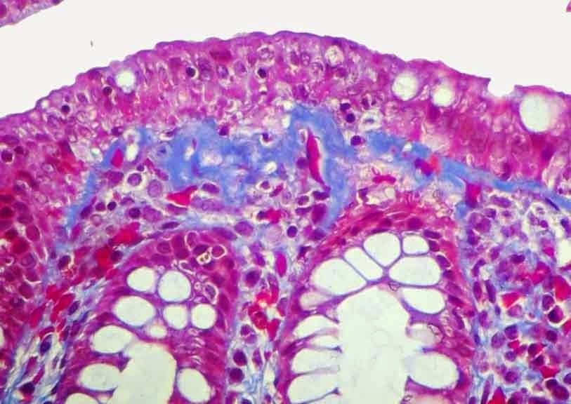 GASTROINTESTINAL AND LIVER HISTOLOGY PATHOLOGY ATLAS: COLON ...