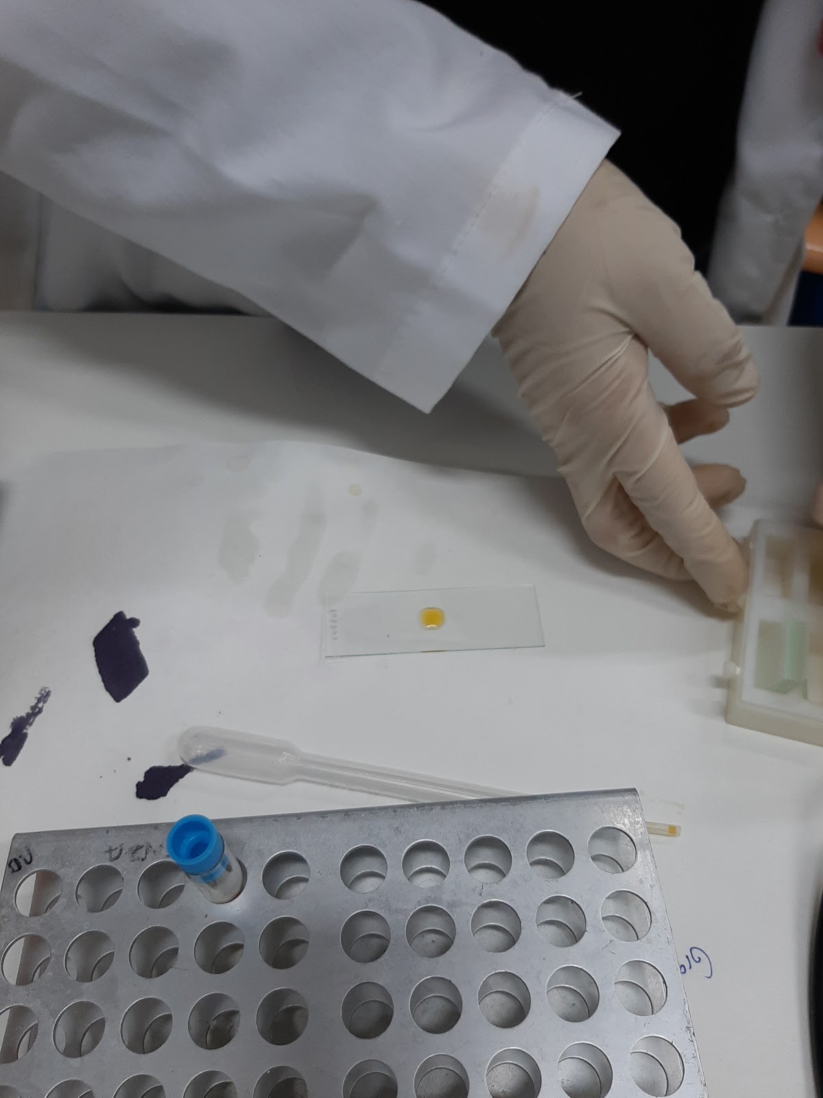 PRÁCTICA 17: TEST DE FILAMENTACION