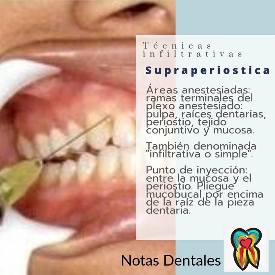 Técnicas de anestesia