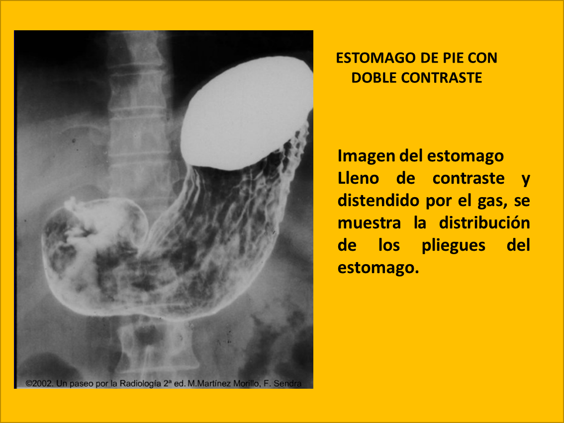 ESTUDIOS ESPECIALES GASTROINTESTINALES : octubre 2014