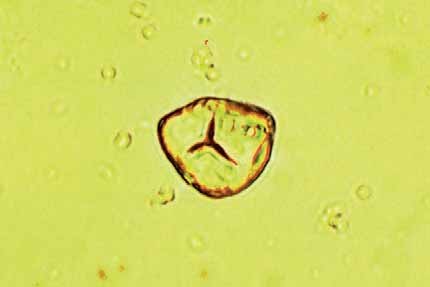[Haematology] Microscopic Examination of Urinary Sediment - ARTIFACTS AND CONTAMINANTS | Free ...