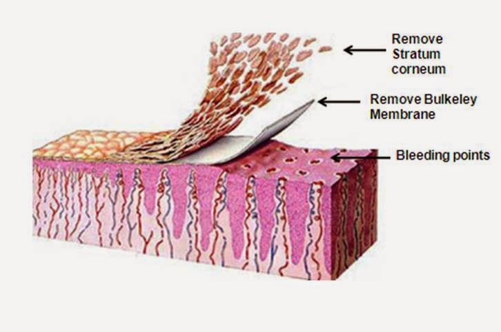 Teledermatology for PG entrance: January 2015