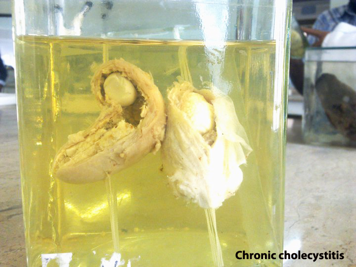 Medical Education for Students: Gross Specimens General Pathology (50 ...