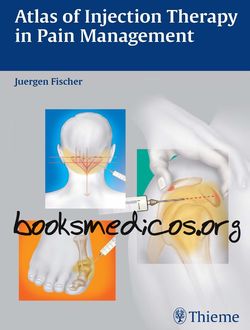 Atlas of Injection Therapy in Pain Management | booksmedicos