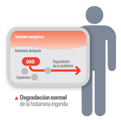 Farmàcia Ausa - Farmàcia a Vic (Farmàcia de Guàrdia): Migrasin ® a la ...