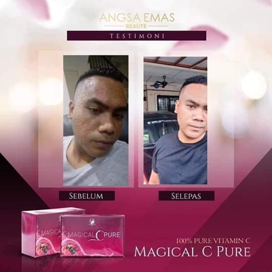 VITAMIN C MAGICAL C PURE PILIHAN SEKARANG