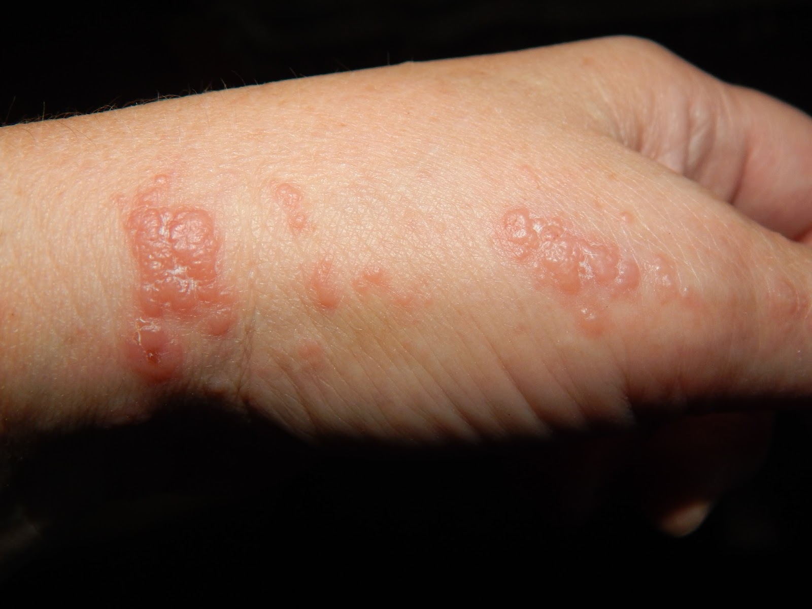 Thoughts from Frank and Fern: It Itches!!