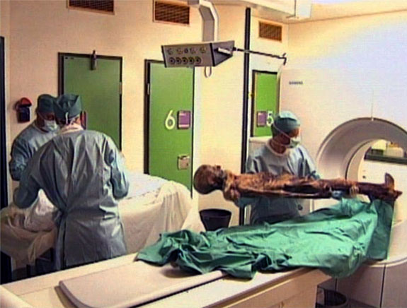 Ötzi - The Iceman: How was the Iceman Killed? ; Changing ...