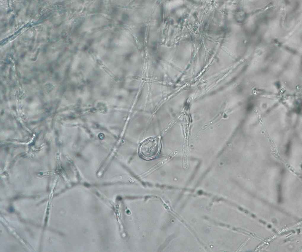 ATLAS MICOLOGIA: TRICHOPHYTON SOUDANENSE (II)