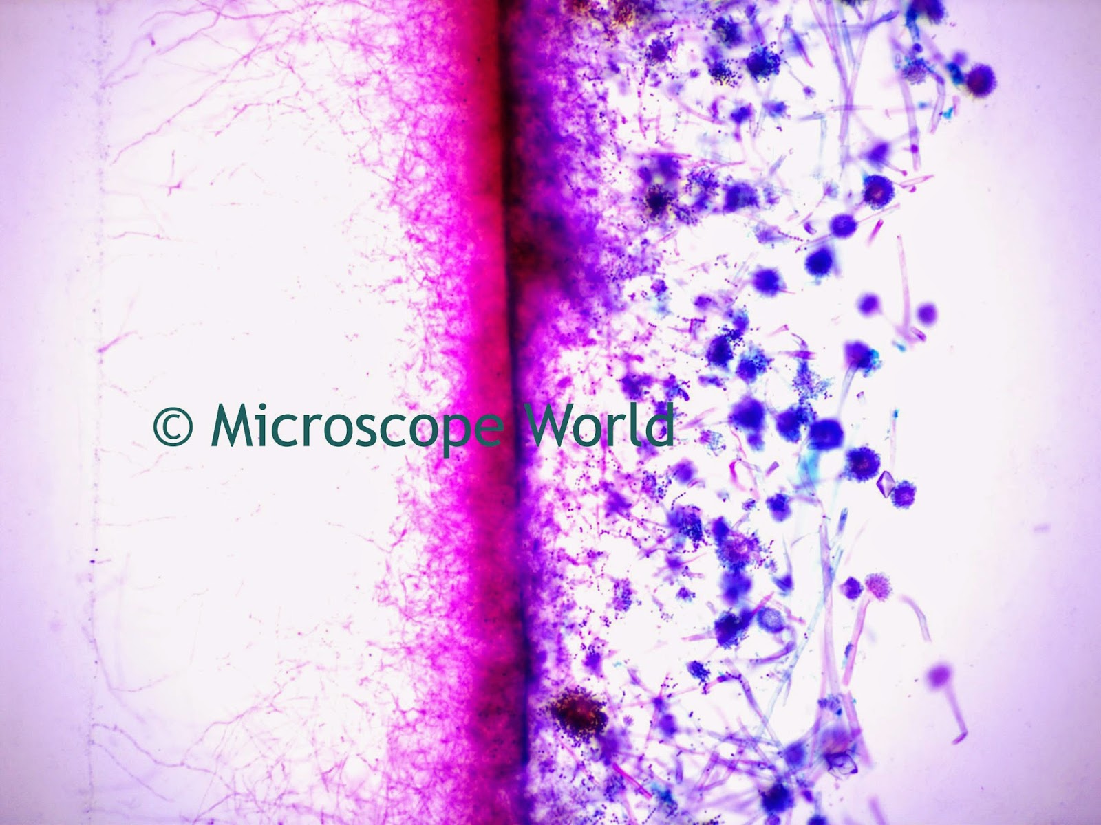 Microscope World Blog: Mold Under the Microscope