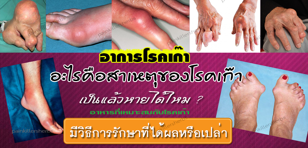 โรคเก๊าท์ Gout Symptom