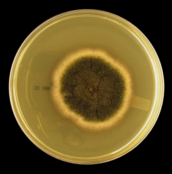Fun With Microbiology (What's Buggin' You?): Pithomyces species