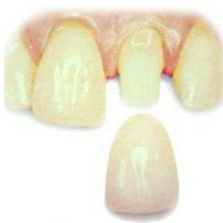 Mengenal Jenis-jenis Gigi Palsu Gigi Tiruan | Cara Membuat Resep Cantik