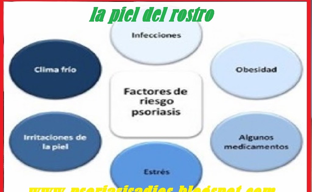 ¿Qué es la psoriasis? Causas, tipos y tratamientos - ¡Guía completa ...