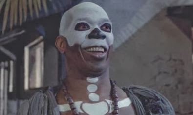 Strange Syndromes: Bone Pointing Syndrome