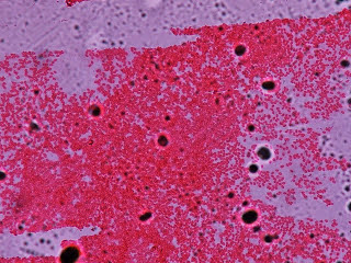 Prinsip Dasar Pewarnaan Gram - Wawan Listyawan