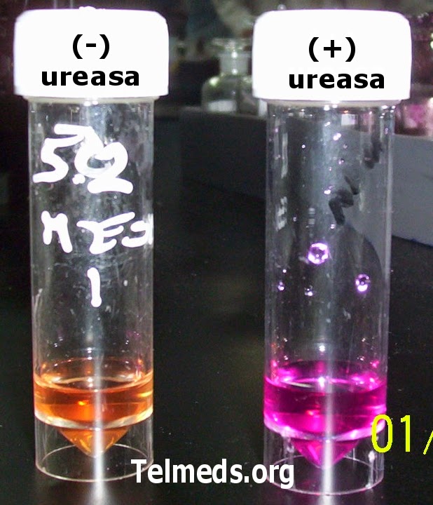 BITÁCORA "VISIÓN LABORATORISTA": UREA