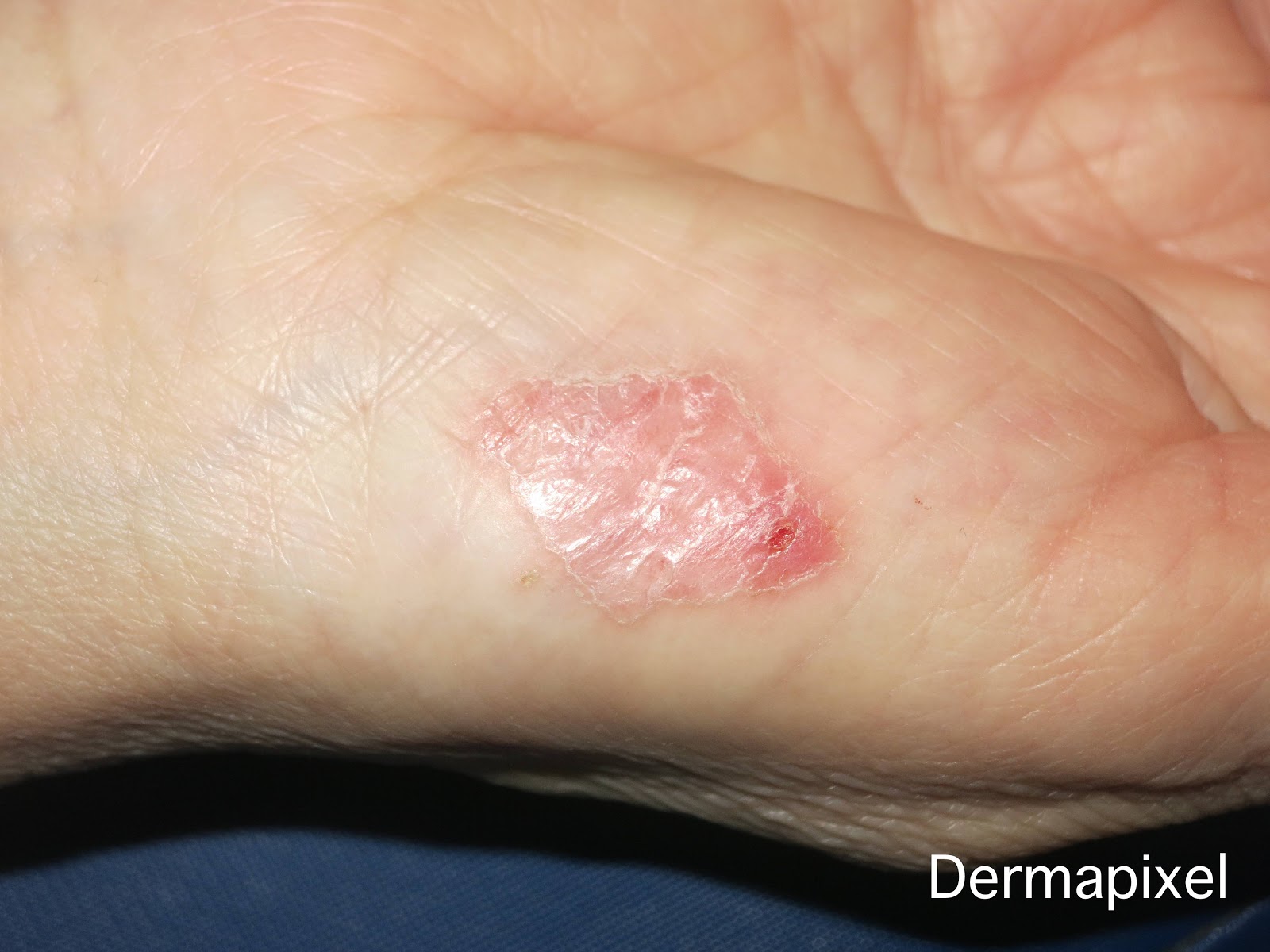 Dermapixel: abril 2020