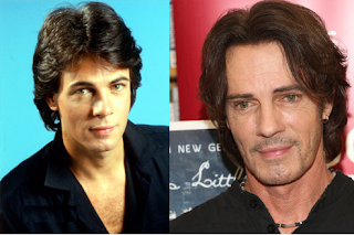 Rick Springfield Plastic Surgery Blog