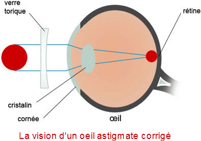 l'astigmatisme - verres optiques