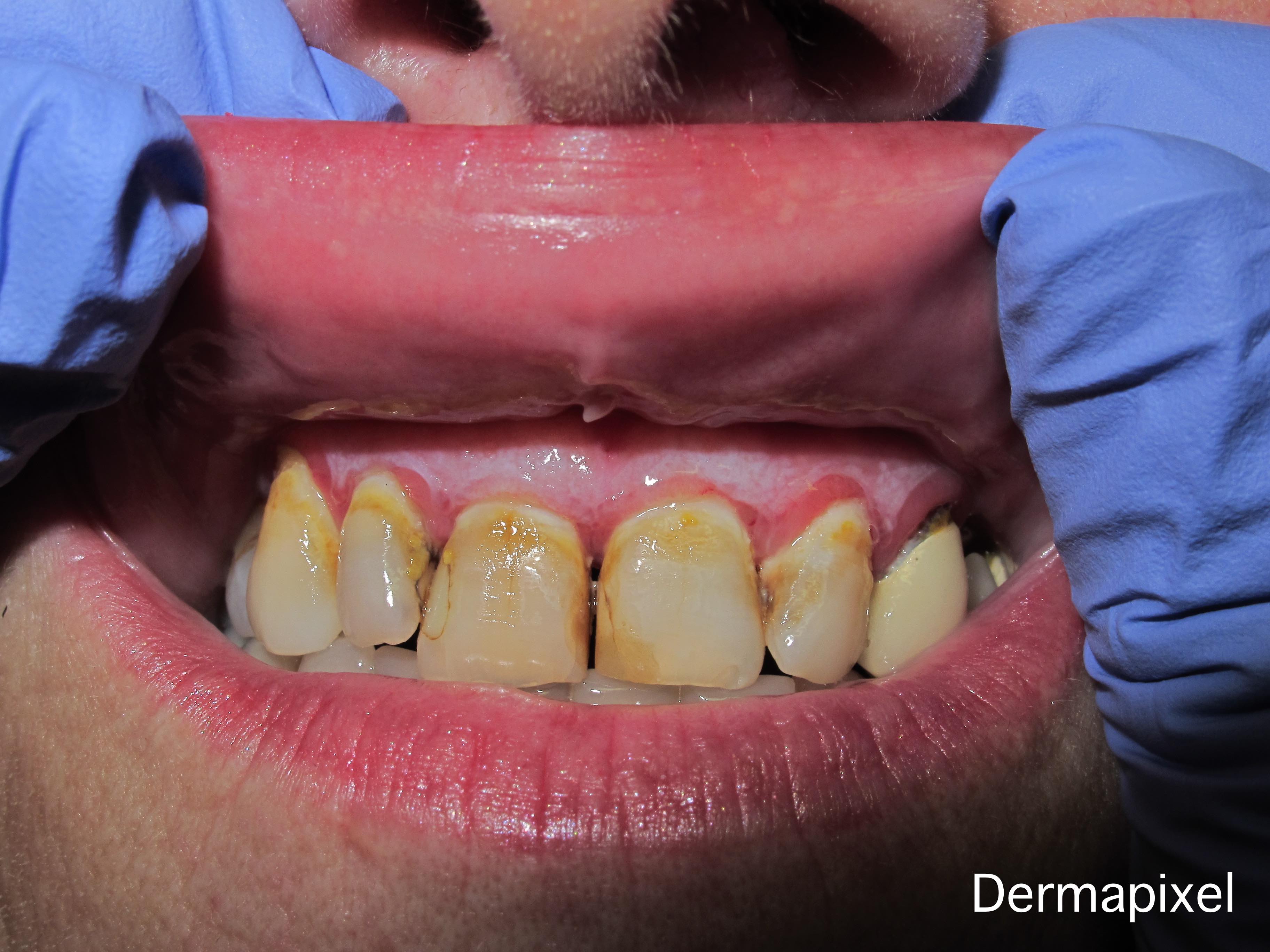 Dermapixel: junio 2021