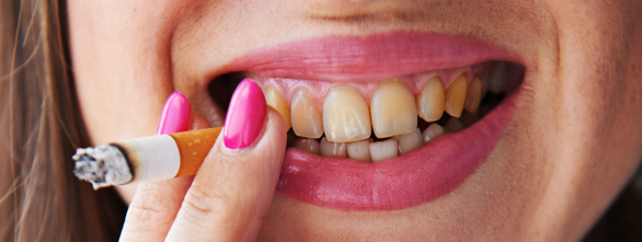 Shoking smoking facts that will let you think about the cigarette consume