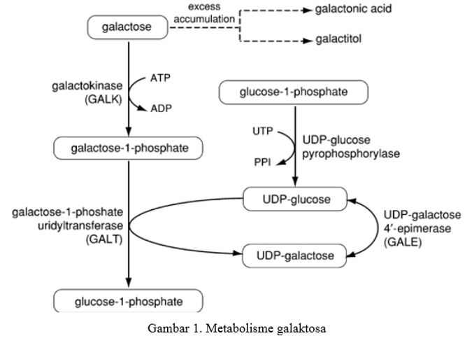 KNOWLEDGE: GALAKTOSEMIA