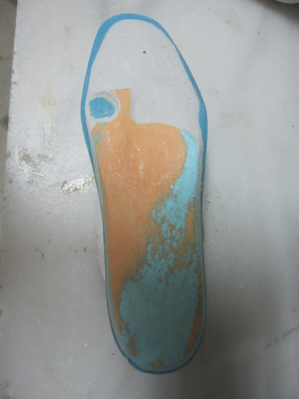 Podo Basas al Día: Heloma en fondo de saco ulcerado. Hallux extensus ...