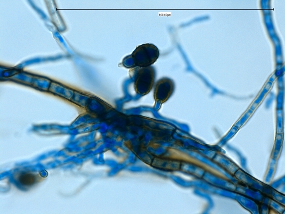 Fun With Microbiology (What's Buggin' You?): Pithomyces species