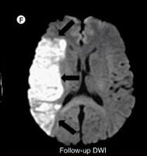 A Doctor in the Works: Neurology: Day 17-25