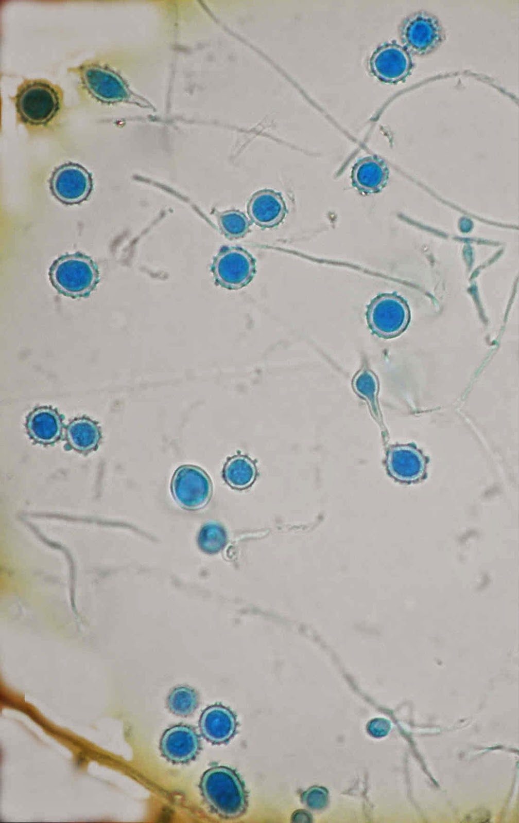 ATLAS MICOLOGIA: CONIDIOBOLUS CORONATUS